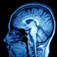 Could NMR-Spectroscopy Eventually Supplement Differential Diagnosis ...